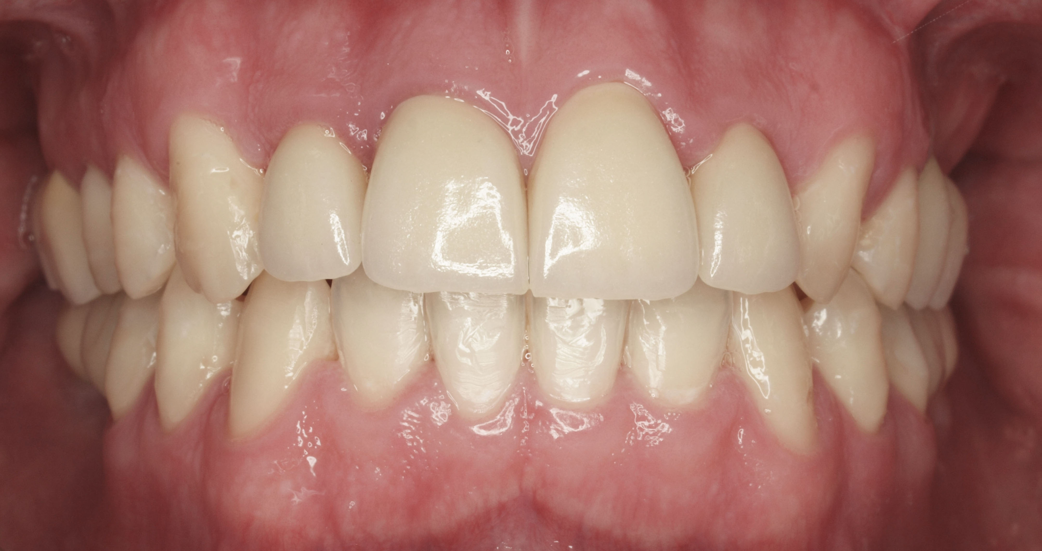 Complex dental cases