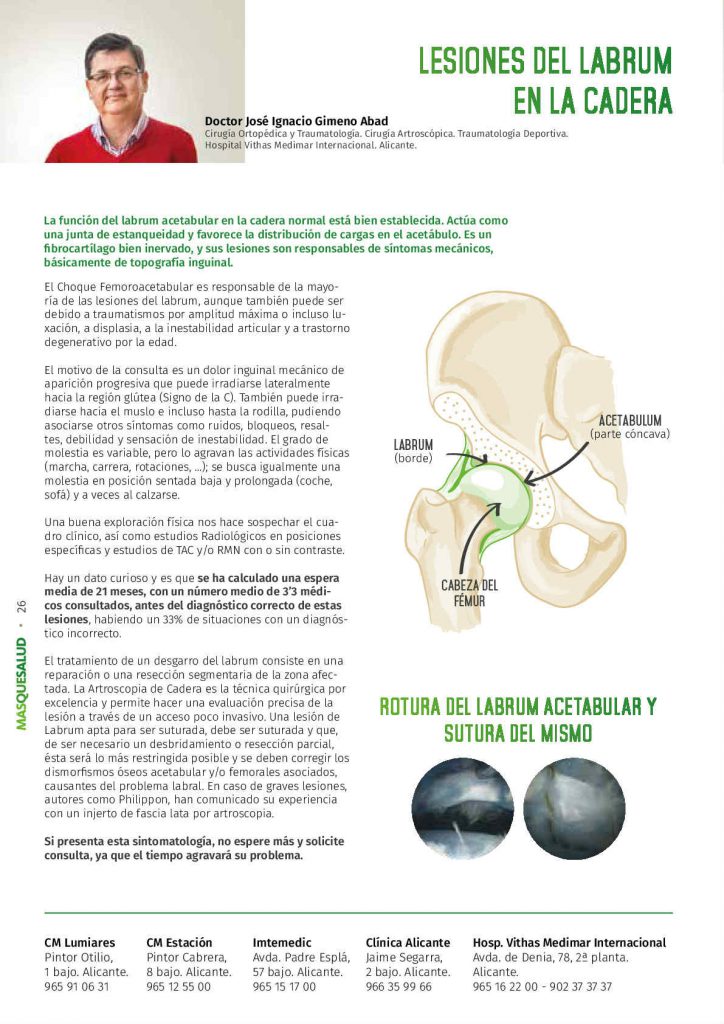 Lesiones del labrum en la cadera - Revista - Mas Que Salud -Toda la ...