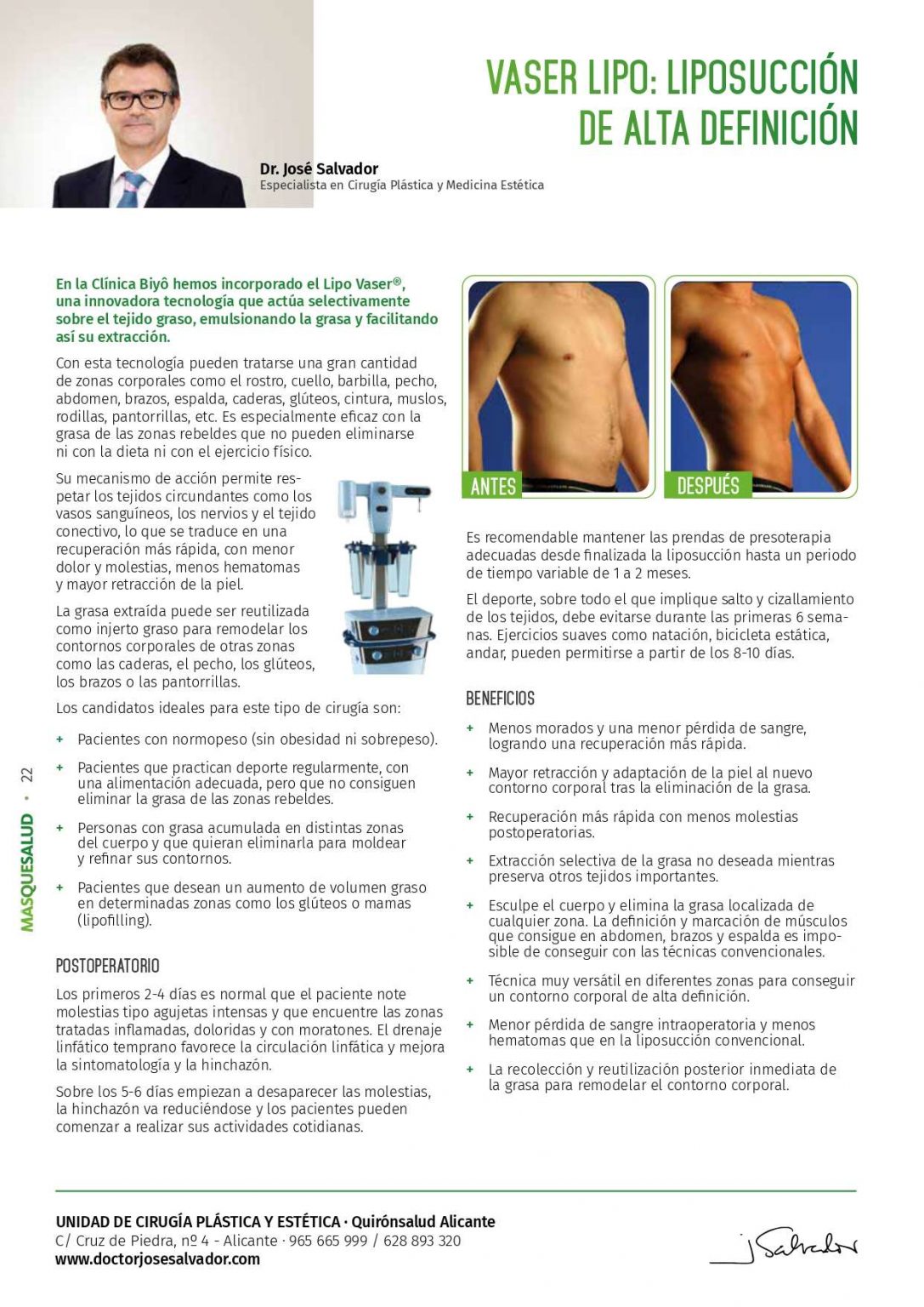 mas que salud 52 22 Vaser LIPO_ liposucción de alta definición ...